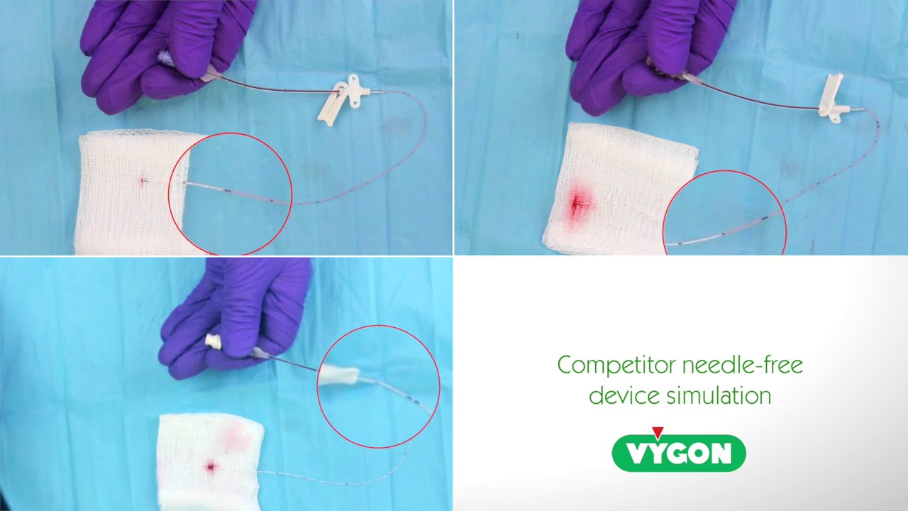 Negative pressure and neutral needle free devices blood reflux - YouTube