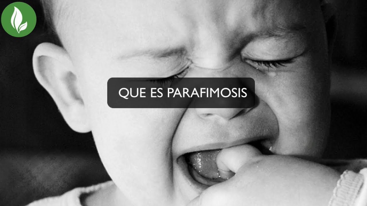 ¿Qué es la Parafimosis? - YouTube