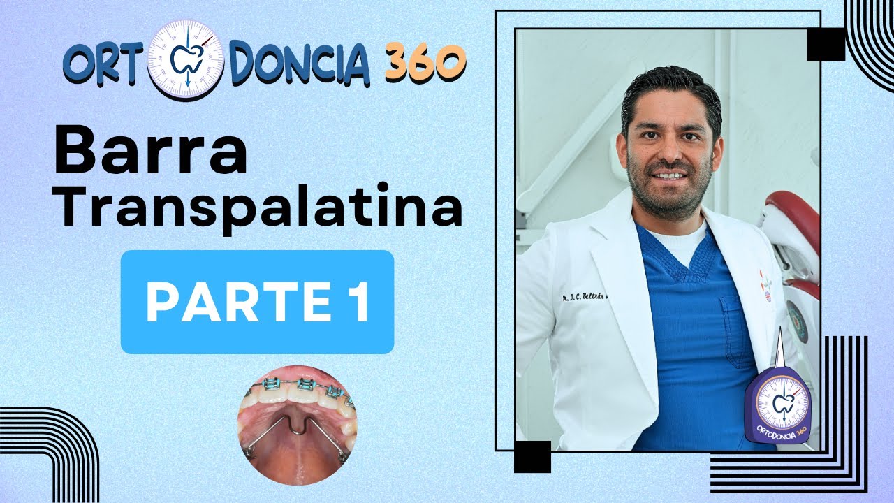 Barra Transpalatina (ATP) 1 de 3 - YouTube