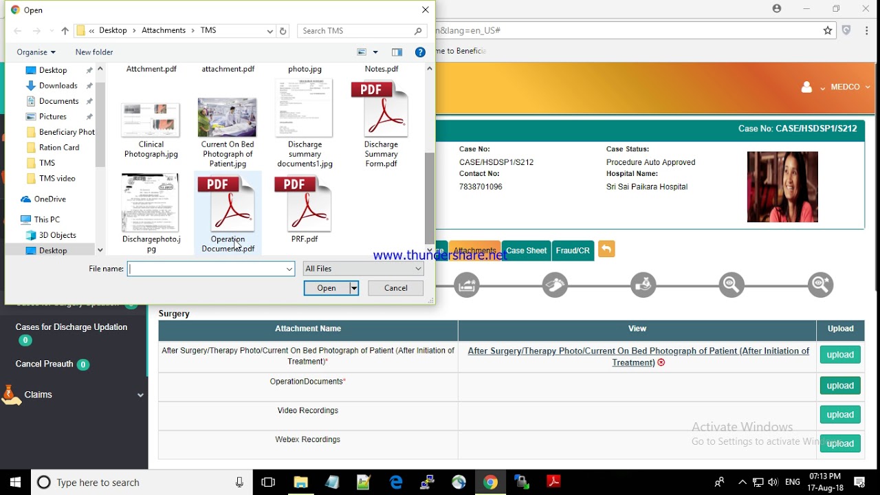 TMS Video Tutorial - YouTube