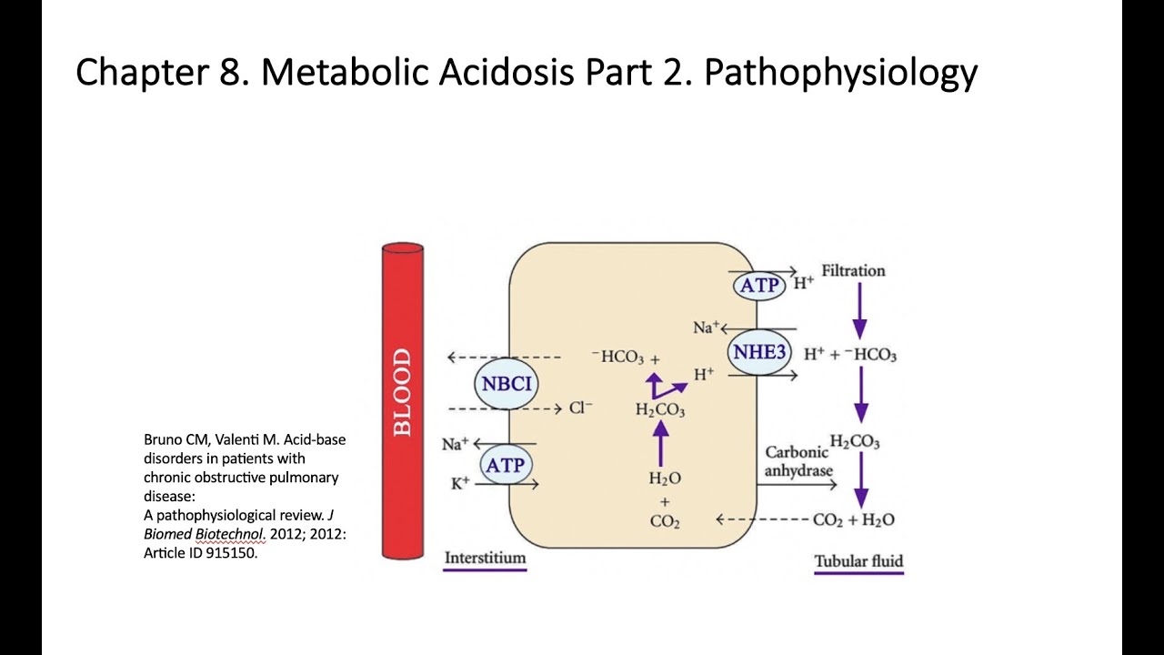 Metabolic Acidosis Part 2. Pathophysiology 1. - YouTube