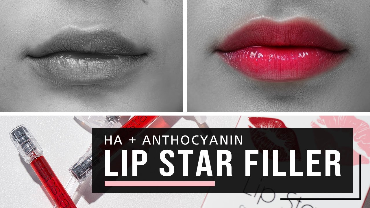 The Volume & Color Korean Lip Star Filler l Learn All About This ...