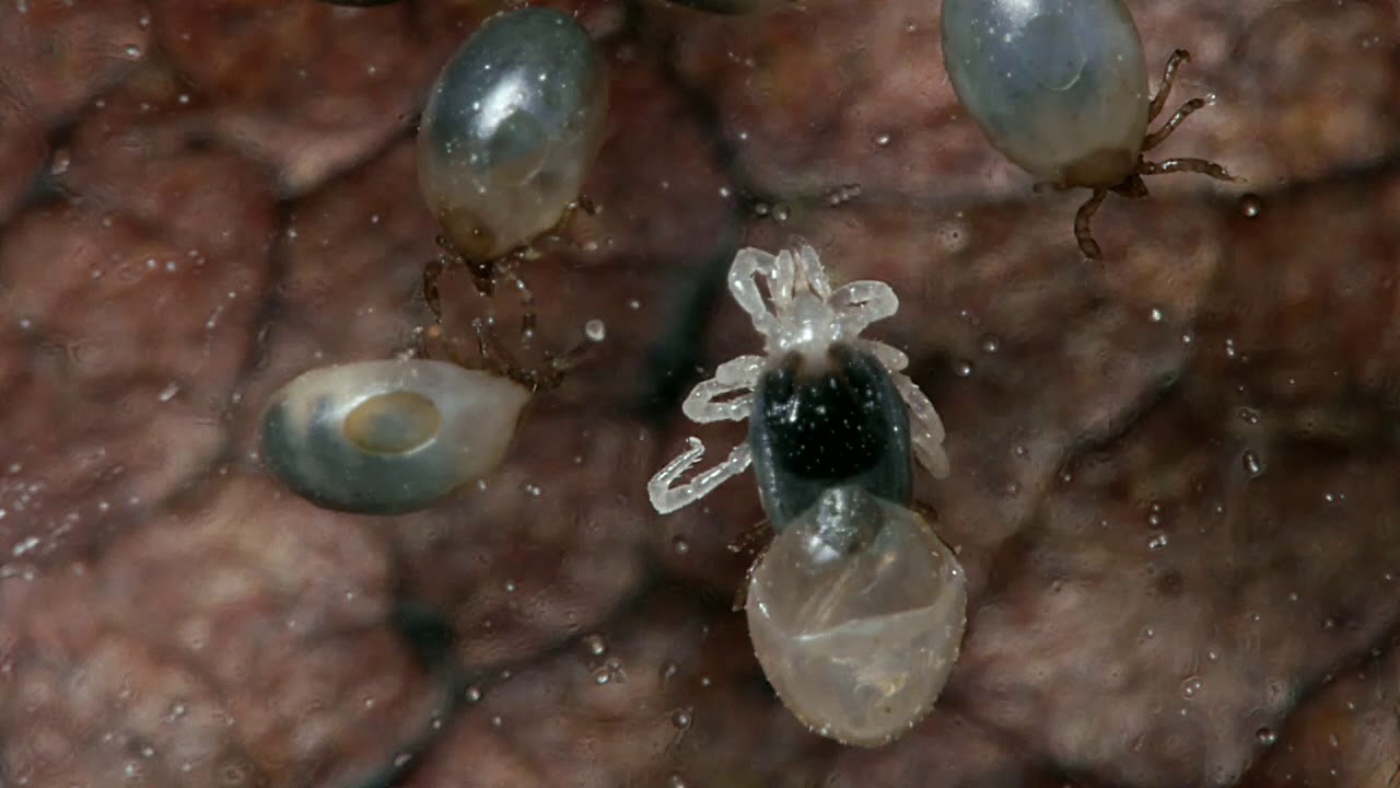 Parasite Case of the Week 472 - YouTube