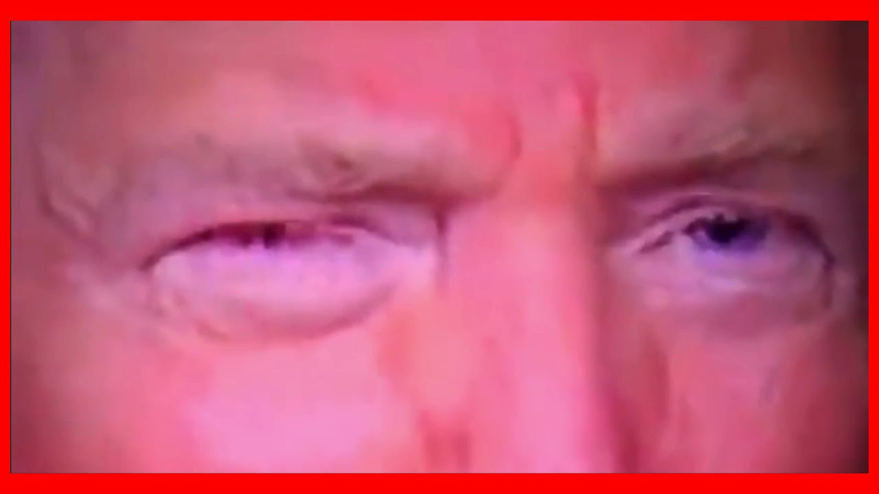 DONALD TRUMP 👁 EYE MALFUNCTION.. - YouTube