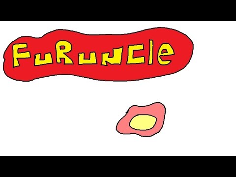 What is Furuncle? - YouTube