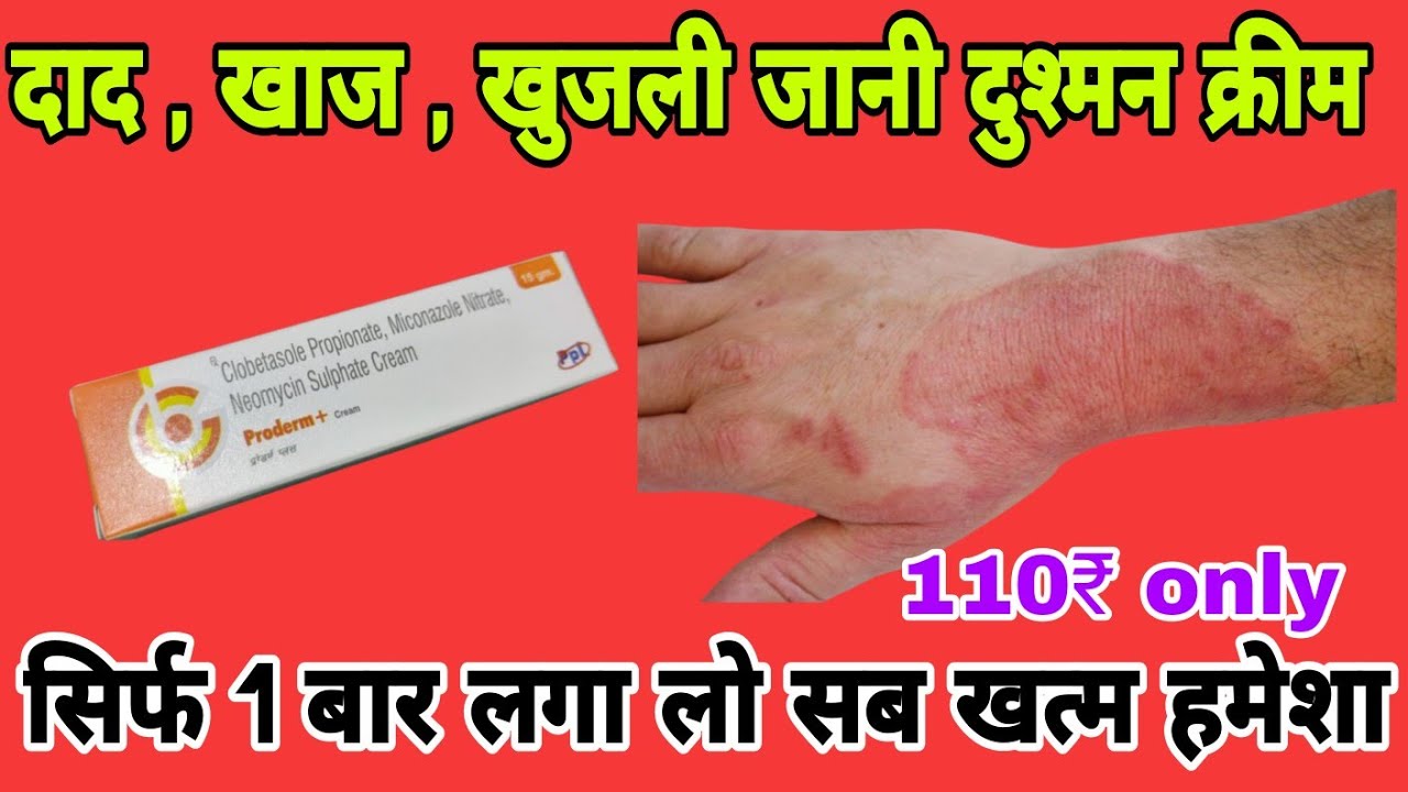 Proderm plus Cream Review in hindi, Uses , Doses , Side effects ...