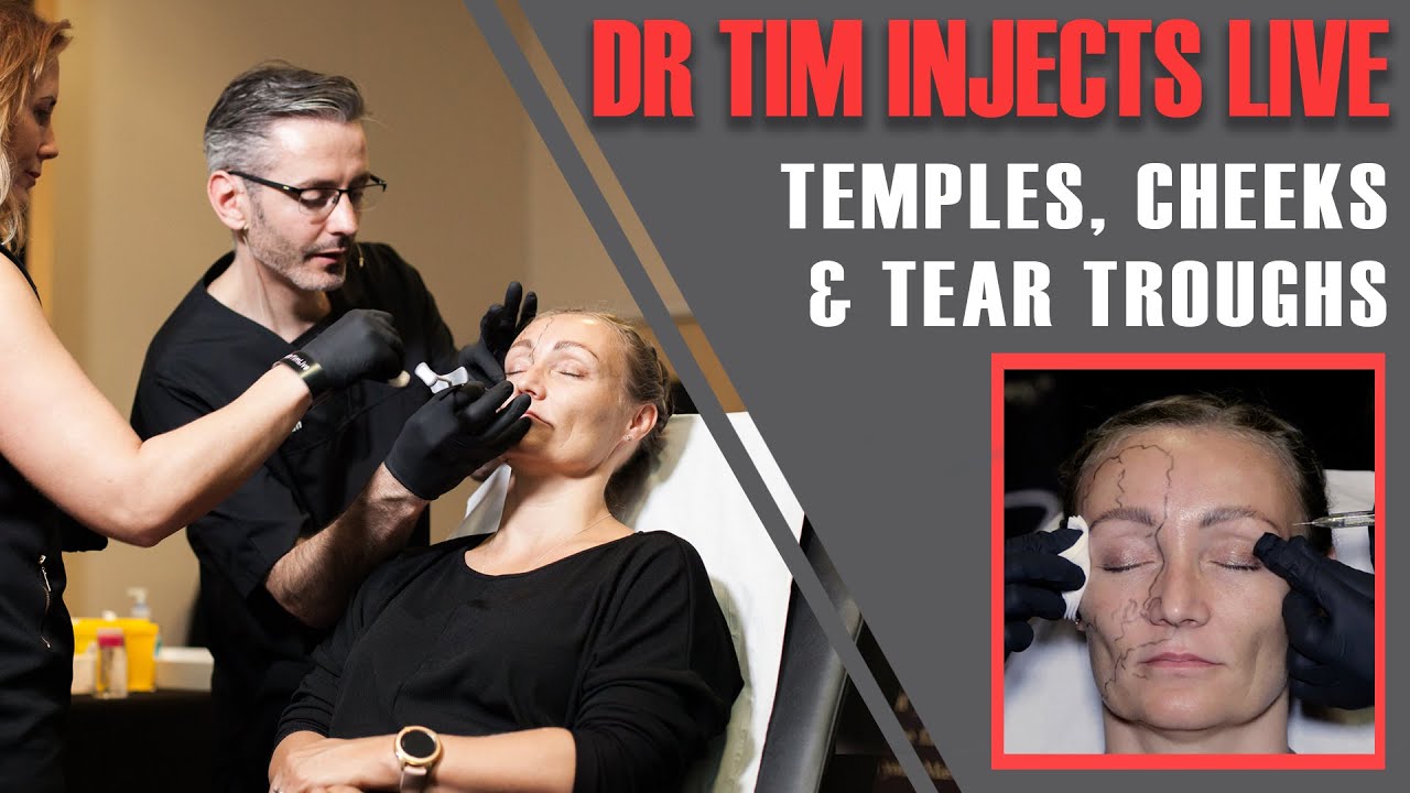 How NOT to inject the BRAIN! Dr Tim injects temples, cheeks & tear ...