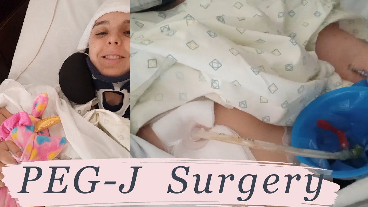 GETTING A SURGICAL FEEDING TUBE: My Experience (PEGJ/GJ) Pre & Post Op ...