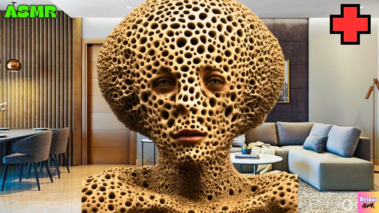 ASMR | HEAVY INFECTED ASMR TREATMENT | REMOVE TRYPOPHOBIA ANIMATION ...