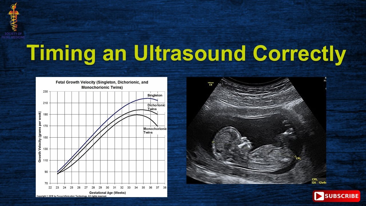 Timing an Ultrasound Correctly - YouTube