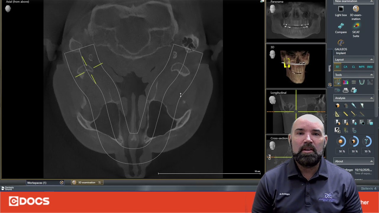 Tip of the Day: Axeos Scan - YouTube