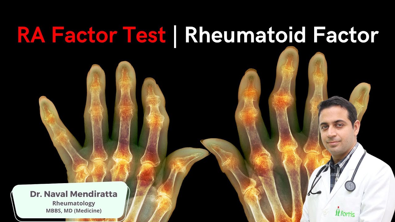 RA Factor Test | Rheumatoid Factor | Best Rheumatologist in Gurgaon ...