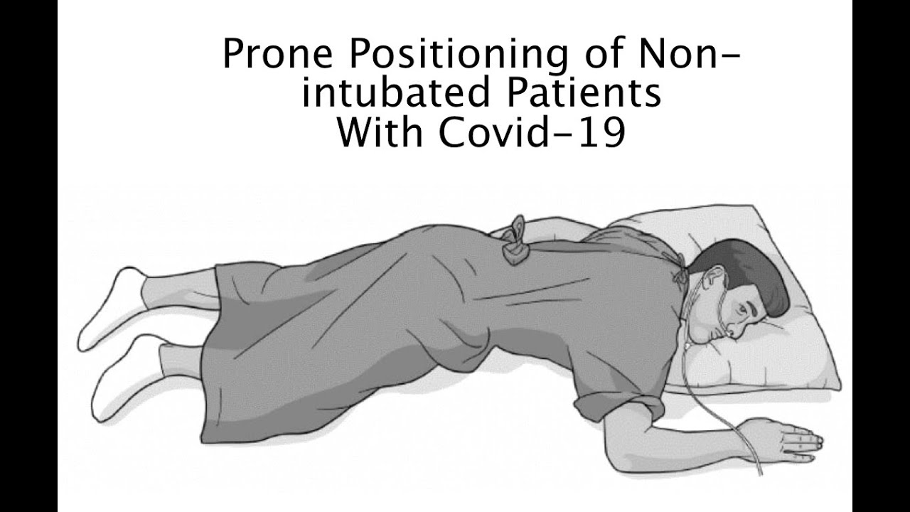 Prone Positioning of Non intubated Patients With Covid 19 - YouTube