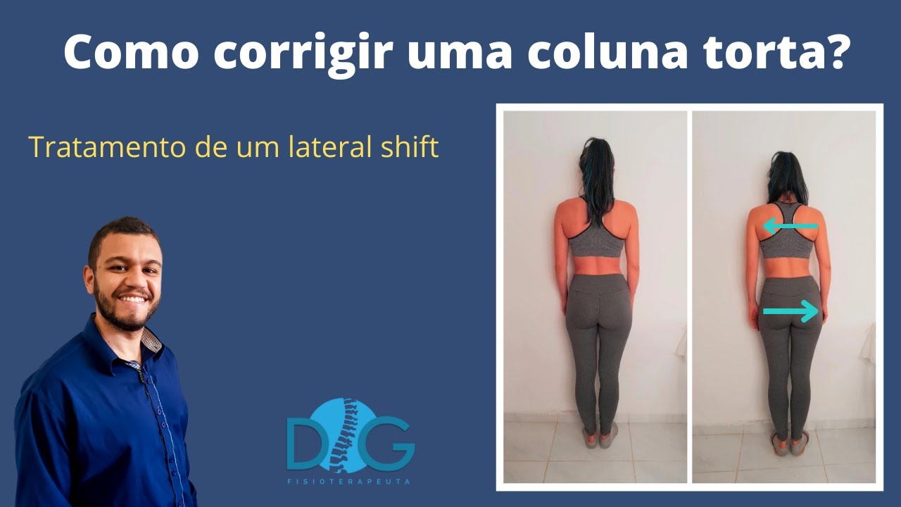Travei a coluna, e agora? Saiba como tratar um lateral shift (na ...
