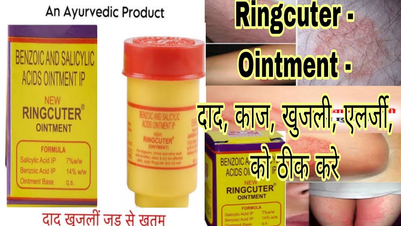 Ring Cutter Ointment दाद खुजली एलर्जी Review Benefits Side Effects ring ...