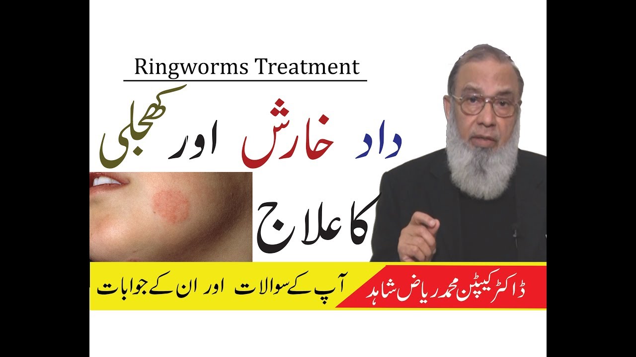 Fungal Infection And Ringworm Treatment Health Tips In Urdu YouTube fungal-infection-and-ringworm-treatment-health-tips-in-urdu-youtube