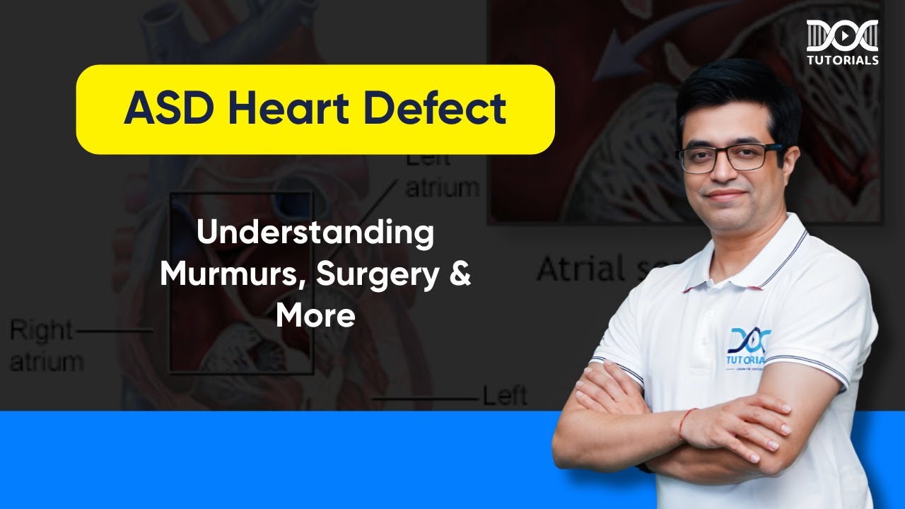 MIQ | ASD Heart Defect | Understanding Murmurs, Surgery & More! | Dr ...