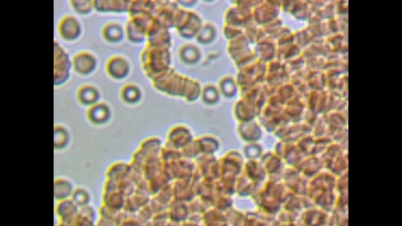 Trypanosomes in three different fresh blood preparations - YouTube