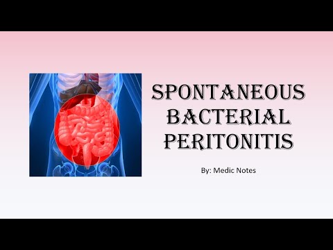 Spontaneous bacterial peritonitis - common organisms, clinical features ...