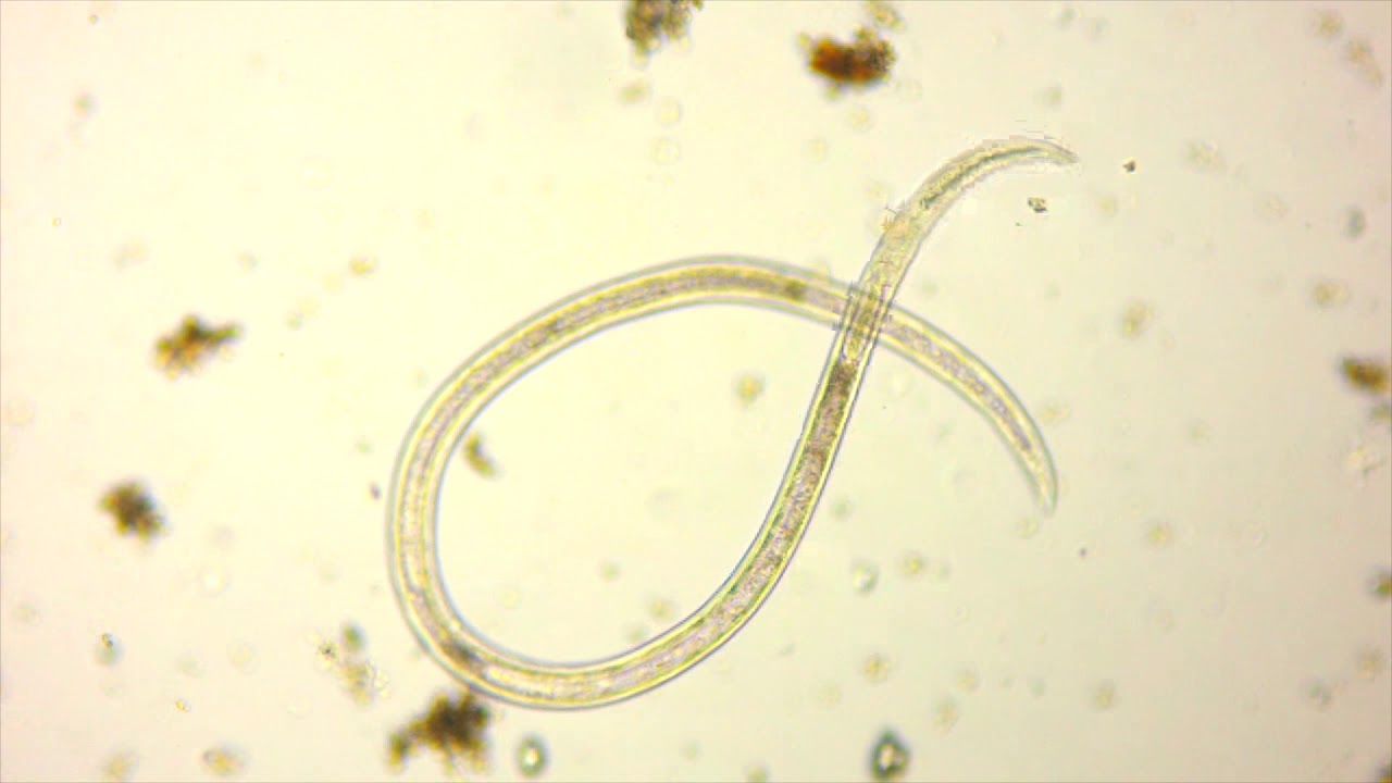 Xiphinema spp - YouTube