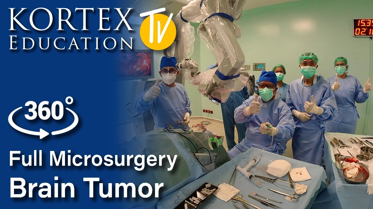360⁰ KORTEX Full Microsurgery for Brain Tumor Performed by dr. Agus ACA ...