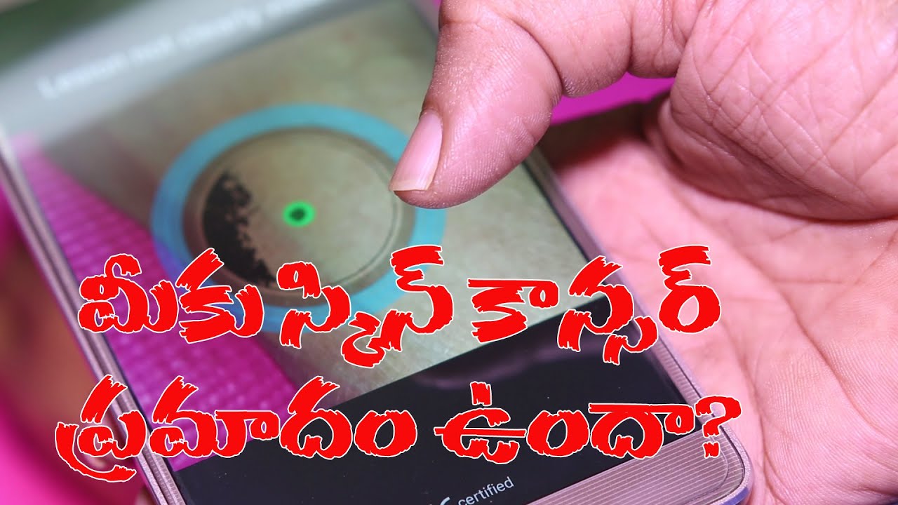 How to Detect Skin Cancer Risk with Android App? - YouTube