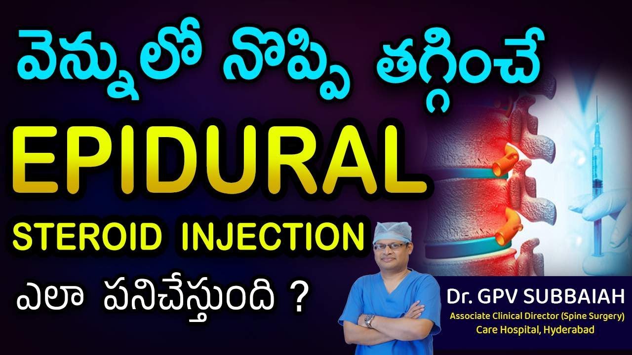 Role of epidural steroid injection in back pain | Epidural steroid ...