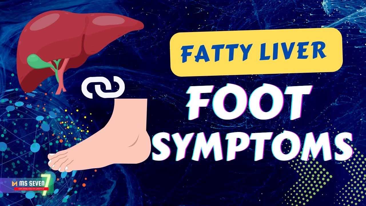Fatty Liver Symptoms from Feet | Foot Liver Connection #youtube # ...