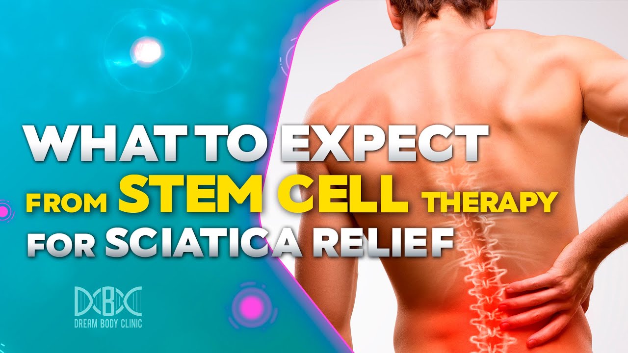 What to Expect From Stem Cell Therapy For Sciatica Relief - YouTube