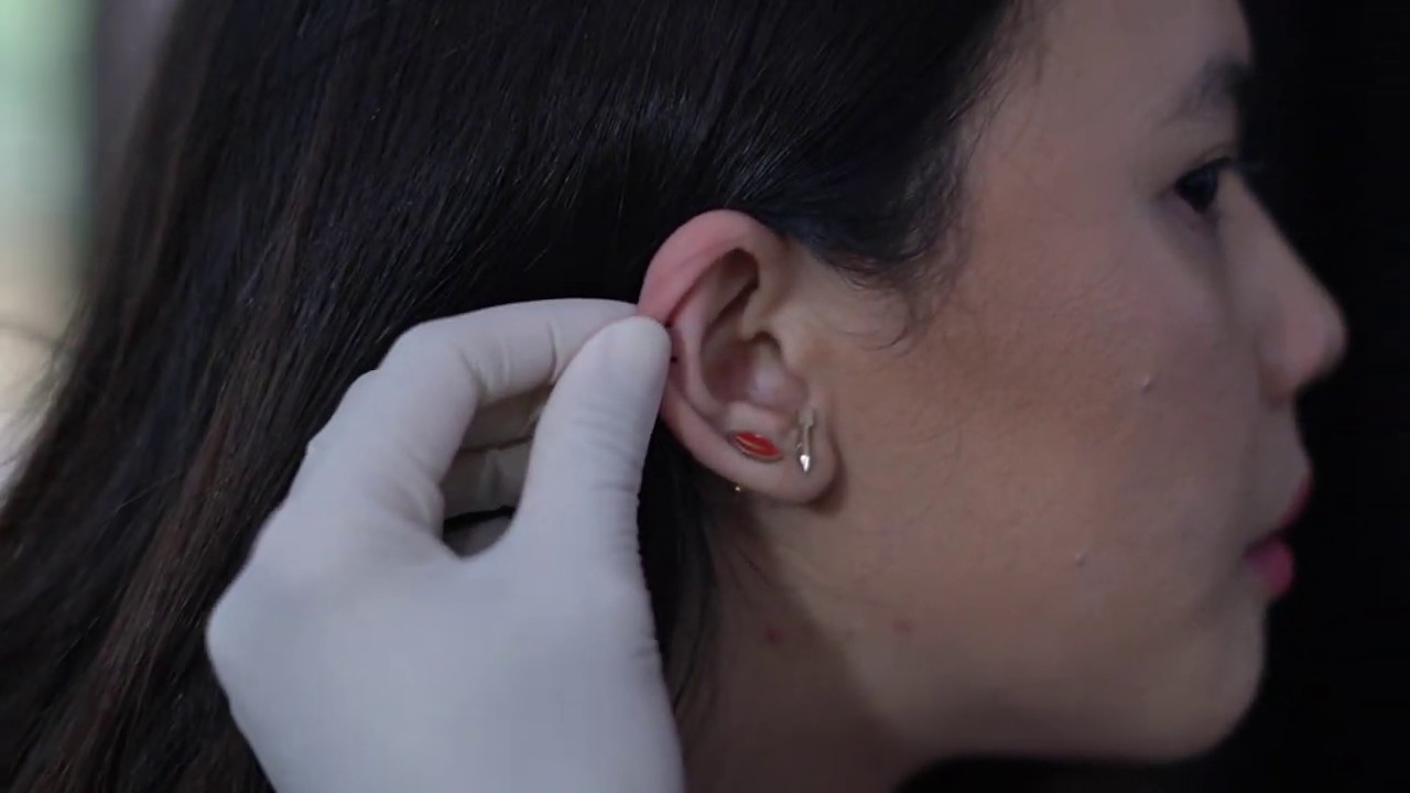 Helix Piercing - Tindik Telinga Helix || Jarum Tindik abbocath 16G ...
