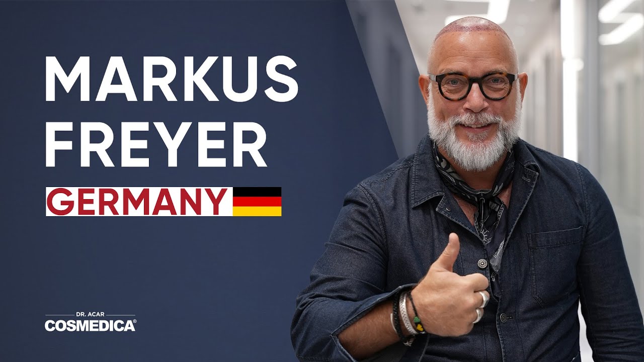 Markus Freyer Hair Transplant Review | Dr. Acar | Cosmedica Clinic ...
