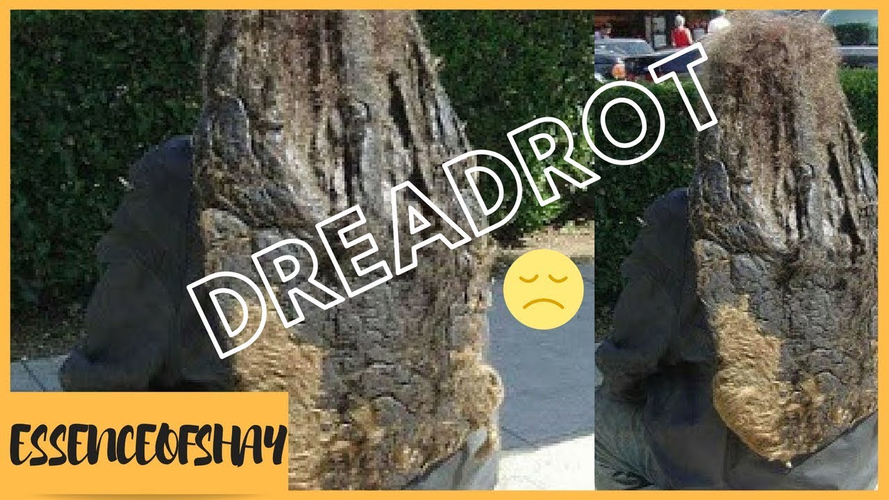 DREADROT AND MOULDY LOCS! IS THIS A THING?? I ESSENCEOFSHAY # ...