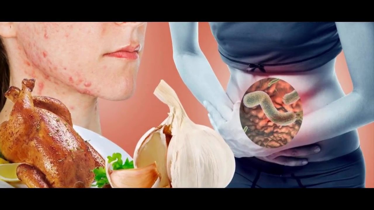 Parassiti intestinali uomo - YouTube