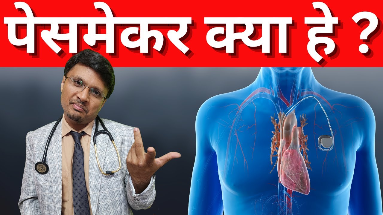 Understanding Pacemakers Boosting Heart Rate - YouTube
