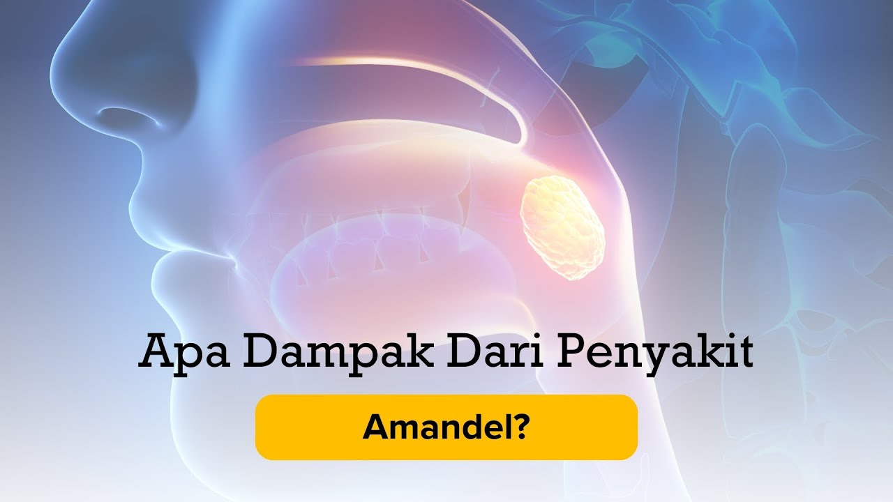 Apa Dampak Dari Penyakit Amandel? - YouTube