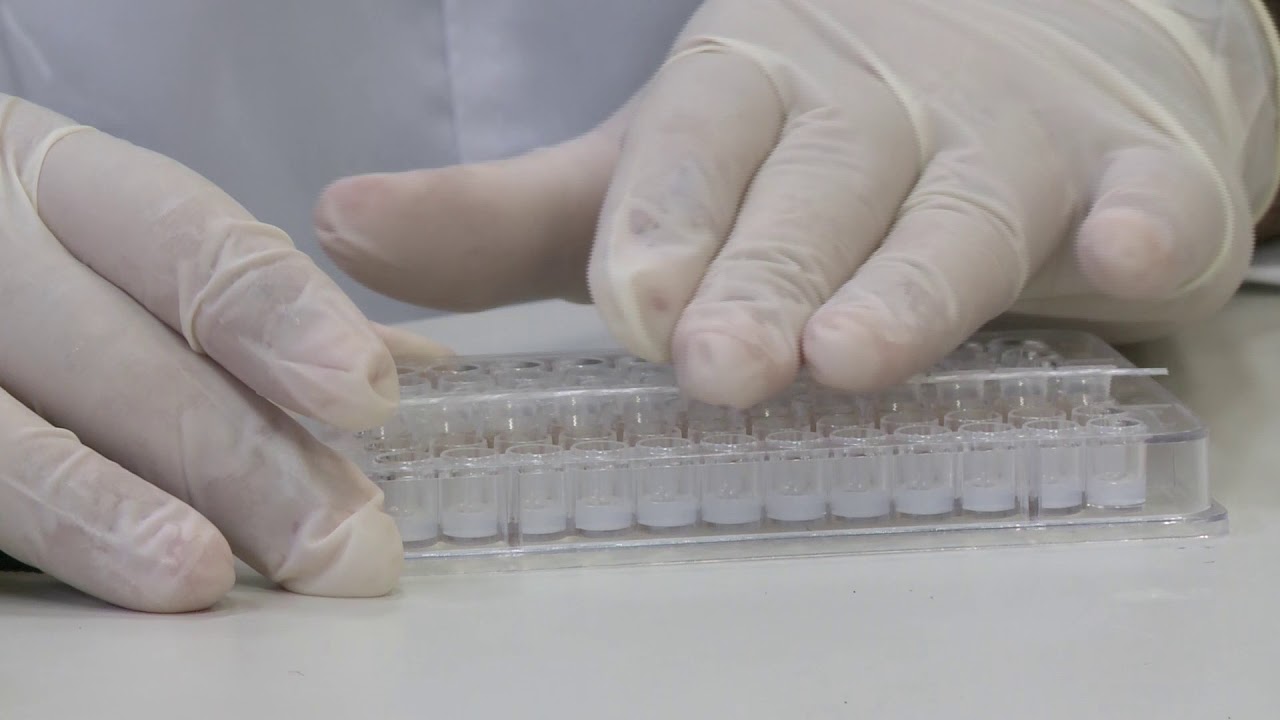 Magnetic bead-based immunoassay - YouTube