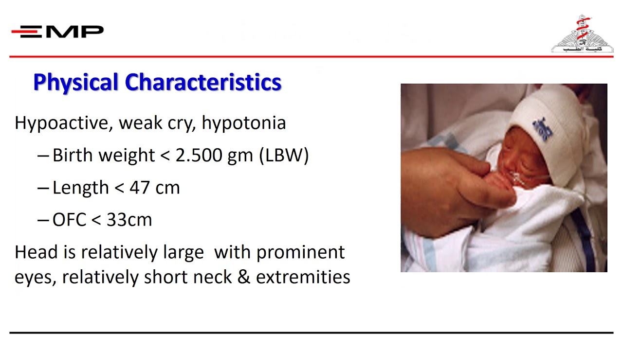 Ballard & physical signs of PT 2 - YouTube