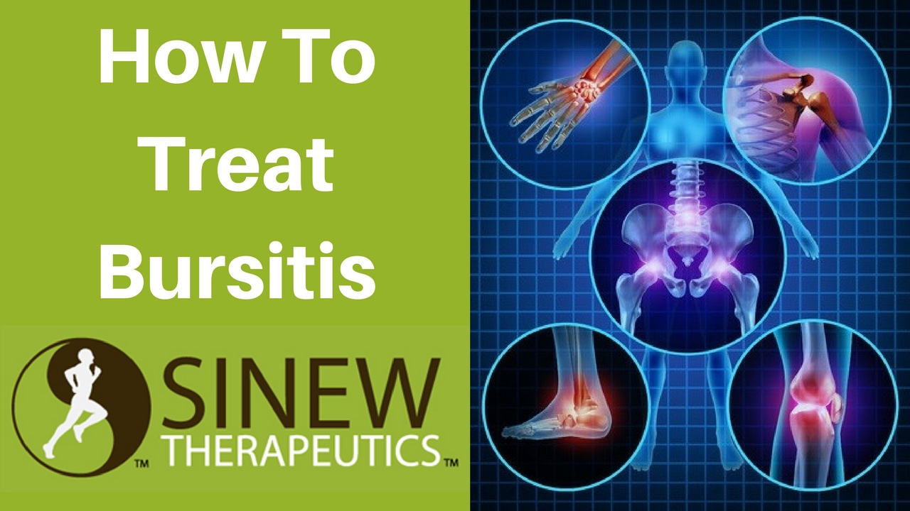How To Treat Bursitis and Speed Recovery - YouTube