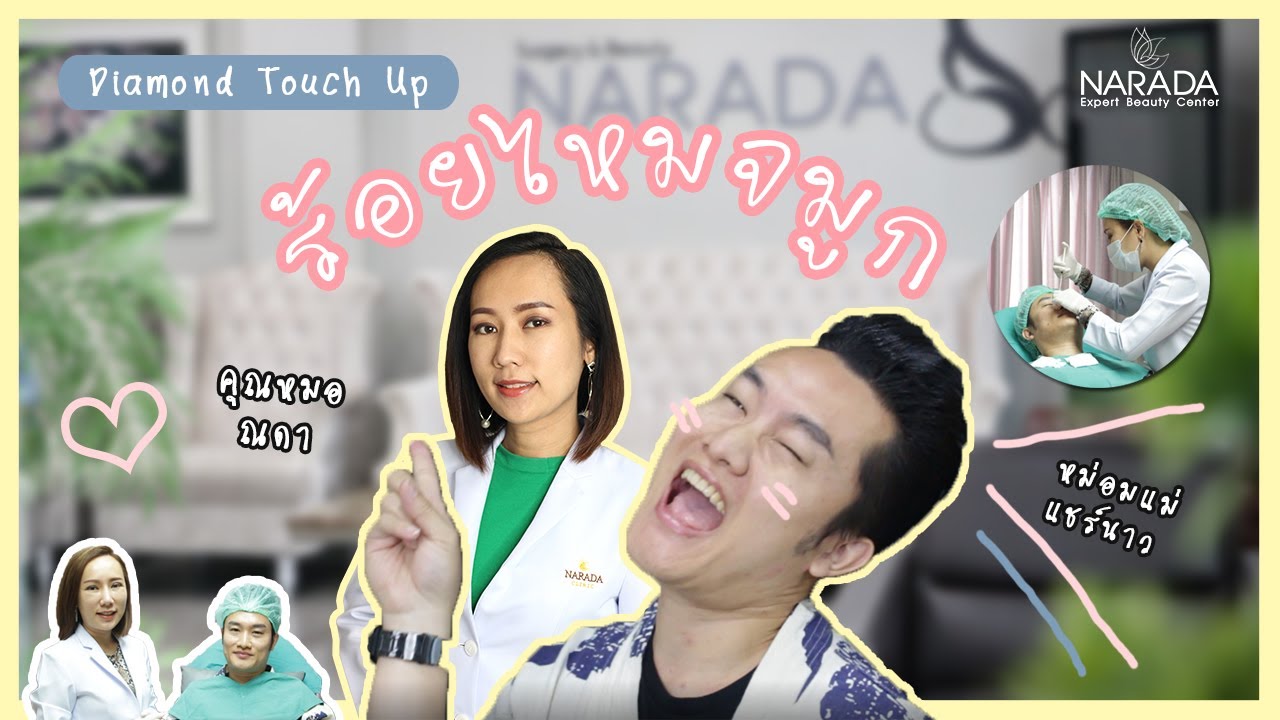 ปรับสันจมูกให้คมชัด ด้วยการร้อยไหมจมูก Dimond Touch Up - YouTube