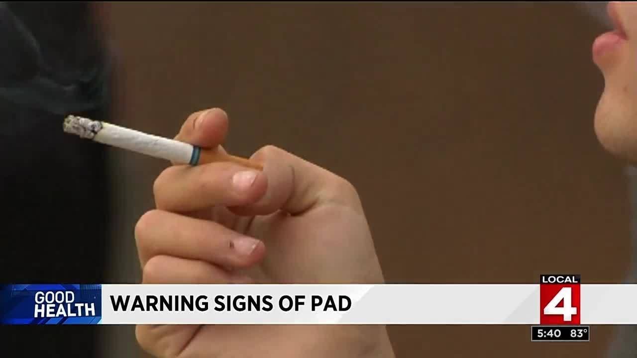 Warning signs of PAD - YouTube