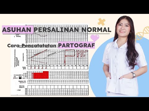 CARA MELAKUKAN PENGISIAN PARTOGRAF | Pencatatan Hasil Pemeriksaan ...
