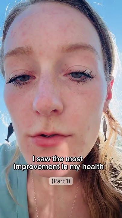 Why You Should Use More Than One Approach Part 1 2 Youtube