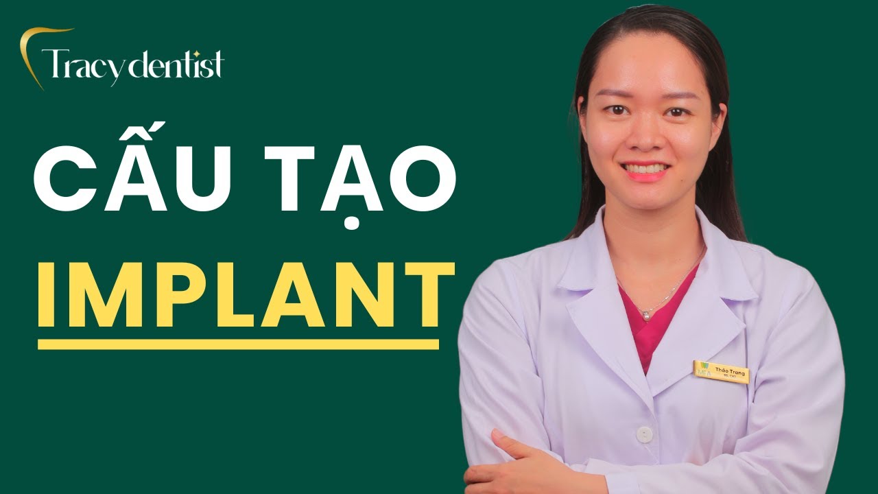 Tìm hiểu cấu tạo của Implant cùng Bs.Trang | Tracy Dentist - YouTube