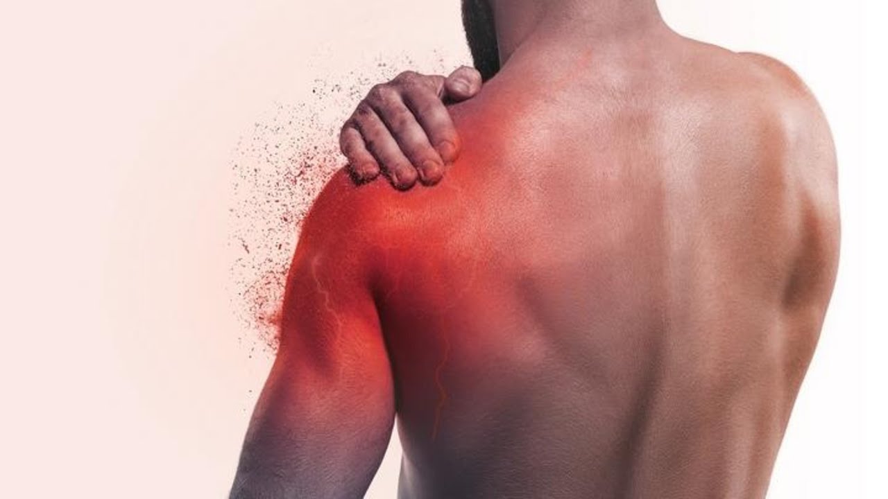ACUPUNCTURE FOR SHOULDER OVERUSE INJURIES - YouTube