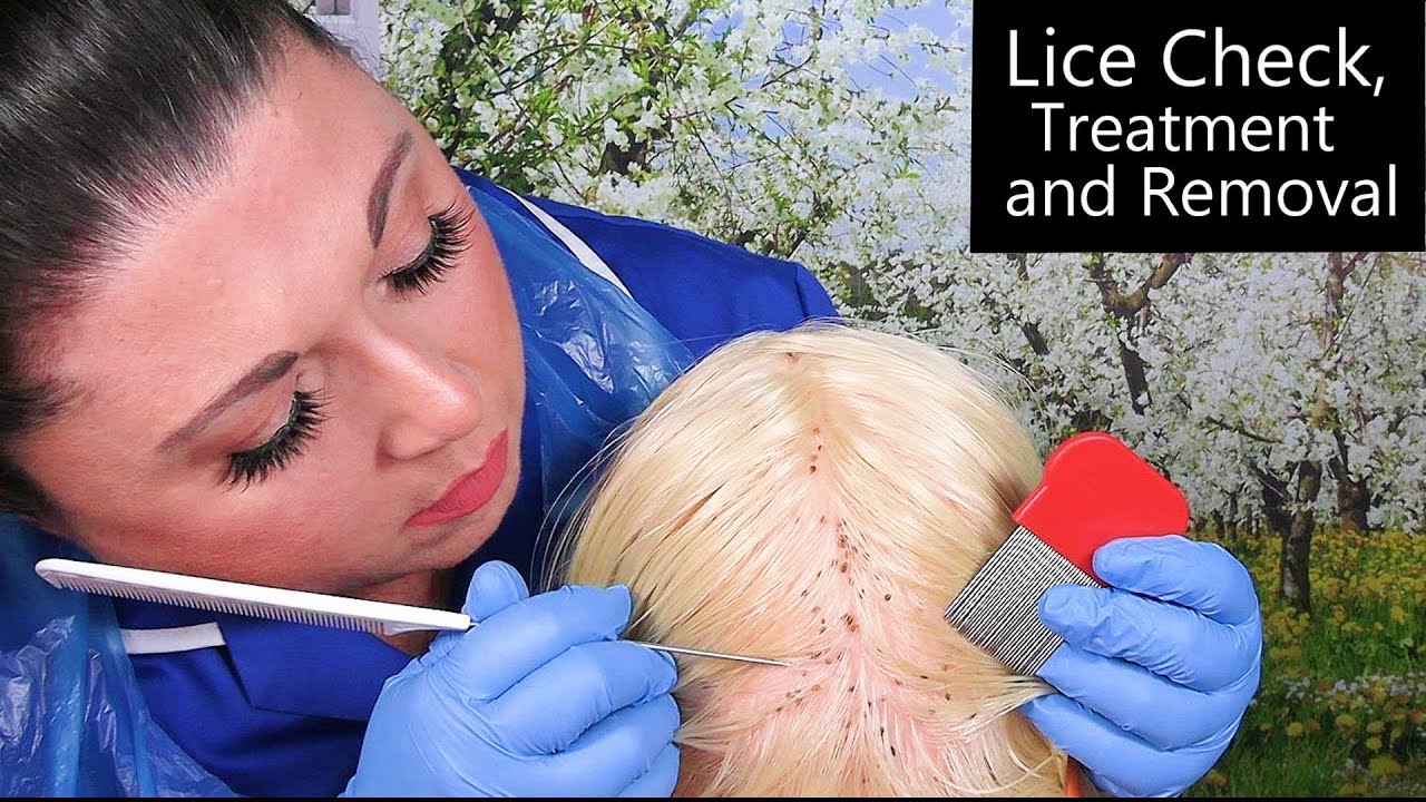 ASMR Lice Check, Treatment and Removal (Lots of Whispering, Gloves ...