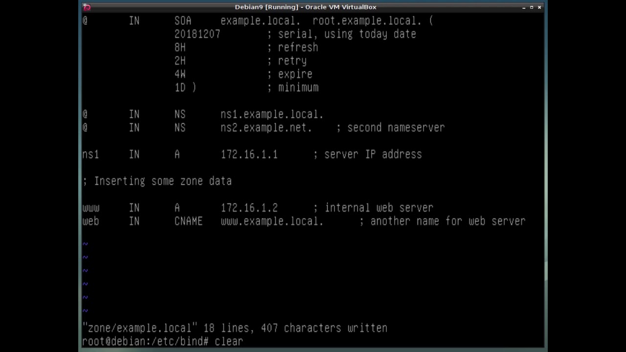 How To Configure A Forward Dns Zone Using Bind Software Youtube