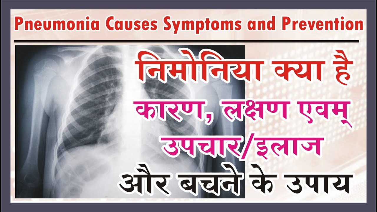 निमोनिया को समझिये, कारण लक्षण और उपचार बचाव Pneumonia Causes Symptoms ...