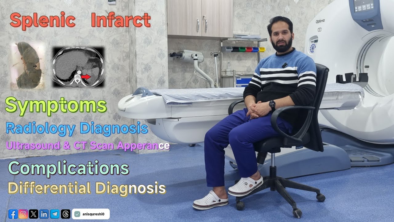 Splenic Infarct | Radiology Apperance | By Anis Qureshi - YouTube