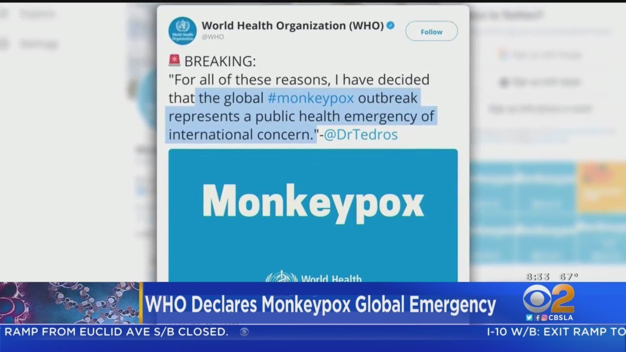 WHO declares monkeypox outbreak a "public health emergency" - YouTube