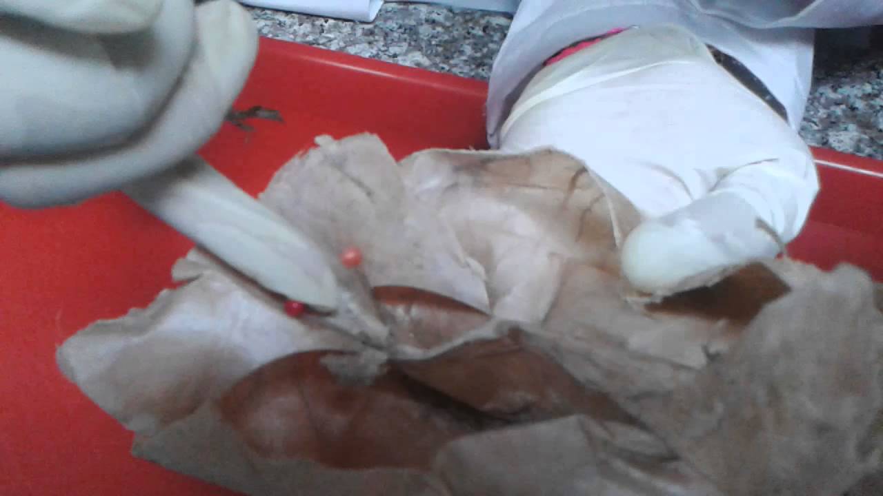 Meninges cerebrales conformación de la duramadre - YouTube